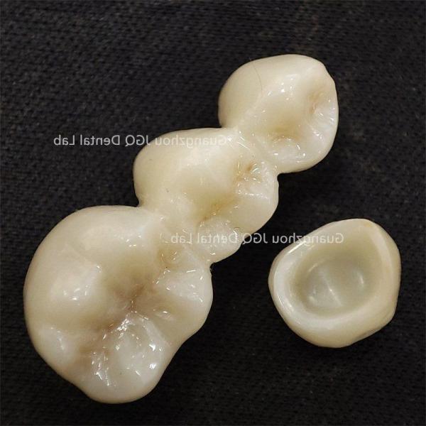 Quality All Ceramic Crown Bridge Dental Laboratory Natural Looking With Aesthetic Effect for sale