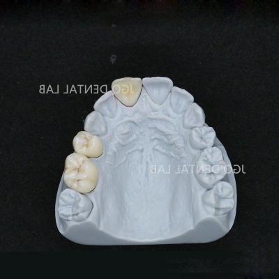 China High Strength Monolithic Zirconia Stable Restoration Competitive Prices China Dental Lab for sale