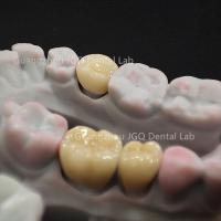 Quality 3Shape CAD CAM Bulk Zirconia Precision Marginal Fit China Leading Lab for sale