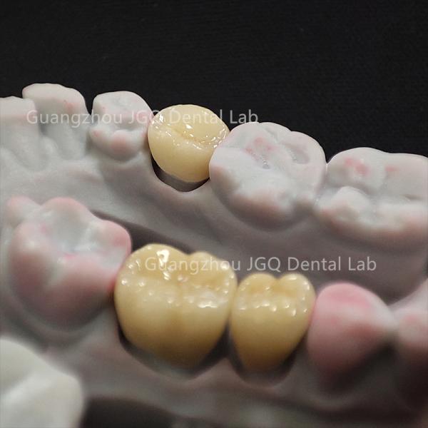 Quality 3Shape CAD CAM Bulk Zirconia Precision Marginal Fit China Leading Lab for sale