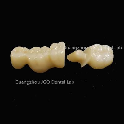 China Medical Grade Zirconia Restorations International Certification Standards for Permanent Clinical Use for sale