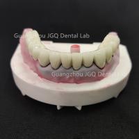 Quality High Strength Monolithic Bulk Zirconia Durable Restoration Solution China for sale