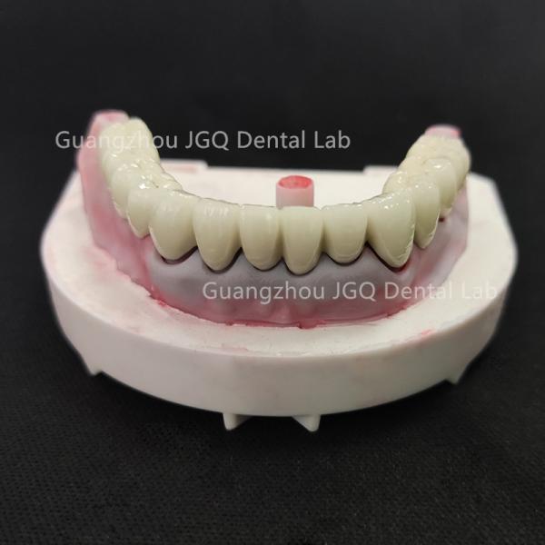 Quality High Strength Monolithic Bulk Zirconia Durable Restoration Solution China Leading Lab for sale