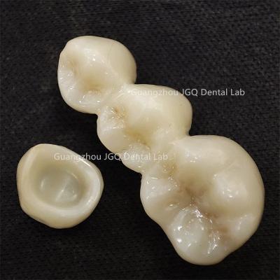 China Hypoallergenic Zirconia Crown Bridge For Permanent Dental Implants for sale