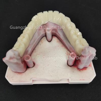 China 3Shape CAD/CAM Aesthetic Layered Monolithic Bulk Zirconia Customizable to Your Needs for sale