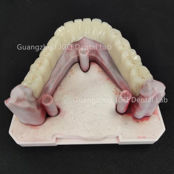 Quality 3Shape CAD/CAM Aesthetic Layered Monolithic Bulk Zirconia Customizable to Your Needs for sale