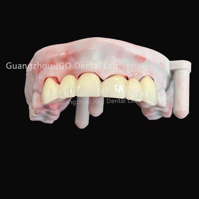 China FDA CE Approved Zirconia Restorations Custom CNC Fabricated Fast Production for sale
