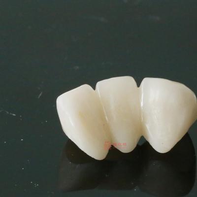 China Bruxism Suitable Zirconia Crown Bridge High Strength CNC Lab Fabrication for sale