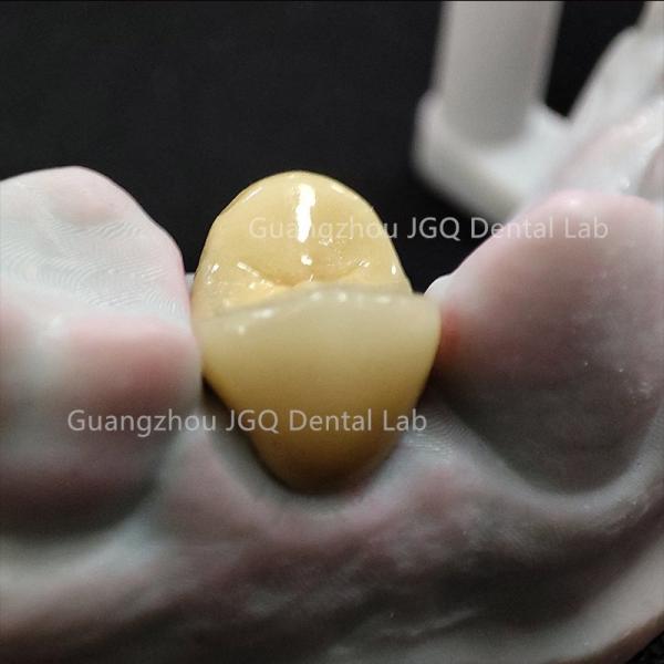 Quality Custom Zirconia Restorations Professional Dental Lab for Global Dental Clinics for sale