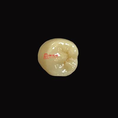 China Zirconia Dentures Teeth Dental Lab Single Crown Anterior Posterior Dental Restoration for sale