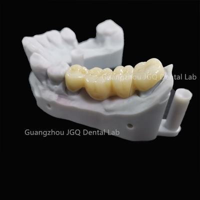 China High Strength Monolithic Zirconia for Bruxism Durable Posterior Tooth Restoration FDA CE Certified for sale