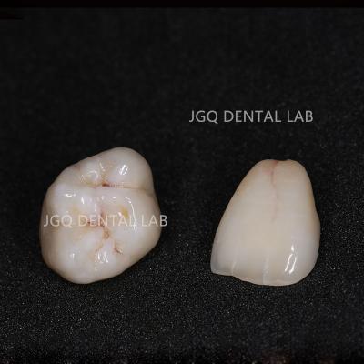 China 3 Shape Lifelike Zirconia Crown Bridge Seamless Integration With Natural Dentition CAD CAM for sale