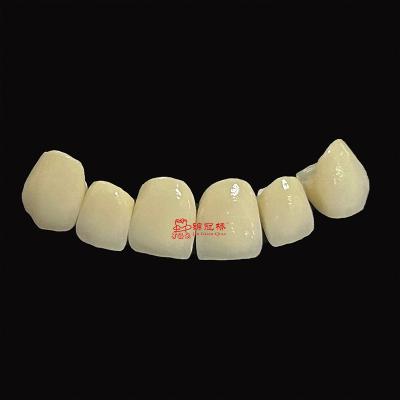China Guangzhou Dental Lab | Custom CNC Milled Zirconia Crowns High Strength Certified for sale