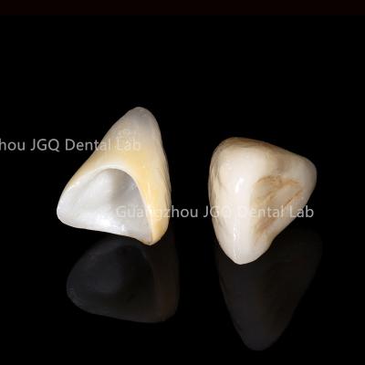 China Custom Dental Lab Biocompatible Zirconia Restorations FDA CE Approved for sale