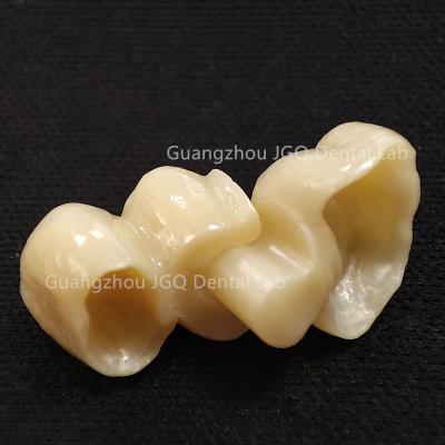 China Dual Zirconia Crown Bridge Precision Crafted By China Dental Lab for sale
