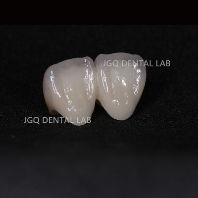 China Custom Layered Zirconia Perfect Shade Matching for Front Teeth Cosmetics for sale