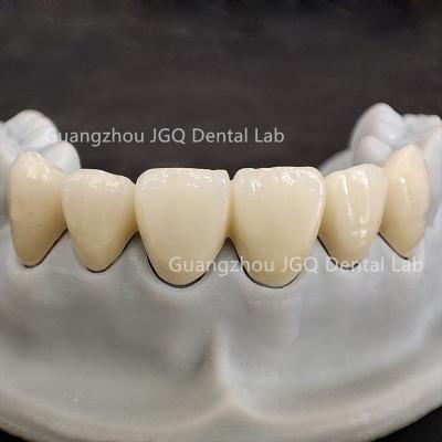 China High Strength Custom Zirconia Prosthesis CNC Fabricated Fast Turnaround for sale