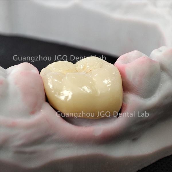 Quality China Professional Dental Lab Custom Precise Marginal Fit Zirconia FDA Certified Hypoallergenic for sale