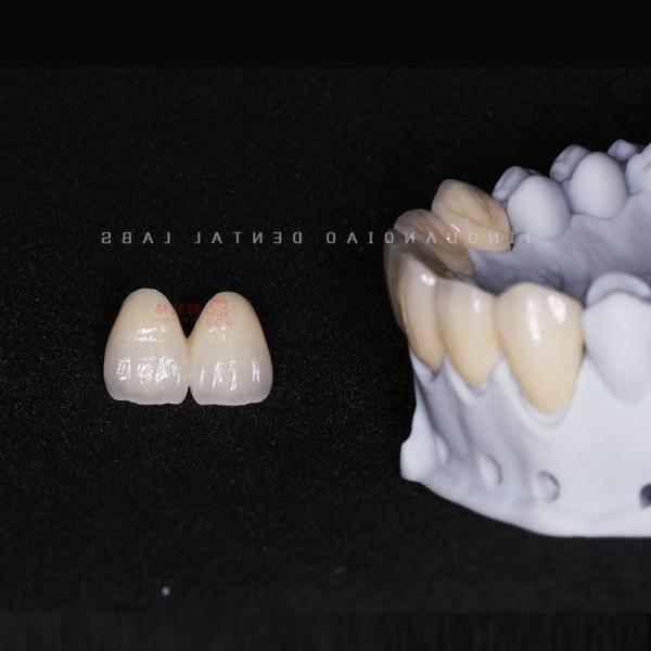 Quality Zirconia Crown Bridge Dental Laboratory China High Accuracy CE FDA ISO Standard for sale