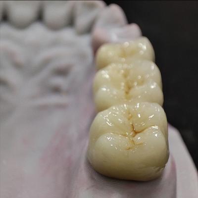 China Ultra Strong Zirconia Crown Bridge Stable Structure For Posterior Restoration for sale