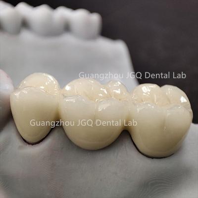China Custom Dental Lab Zirconia Crown Bridge Full Anatomical Design High Accuracy Quick Delivery for sale
