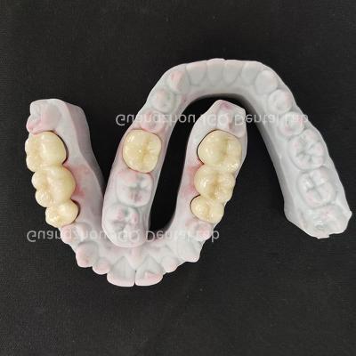 China Layered Aesthetic Zirconia Crown Bridge Perfect Margin Fit CNC Precision Milled Custom Made for sale