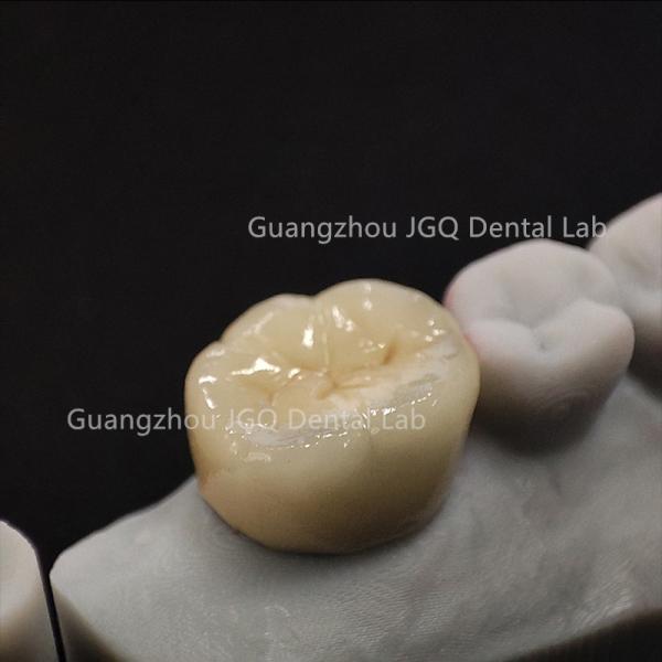 Quality Trusted Chinese Dental Lab Supply High-Quality Monolithic Zirconia Natural Look Long Service Life for sale