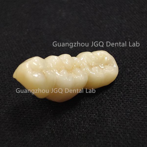 Quality High Quality Monolithic Zirconia Smooth Surface Precise Margin Fit for sale