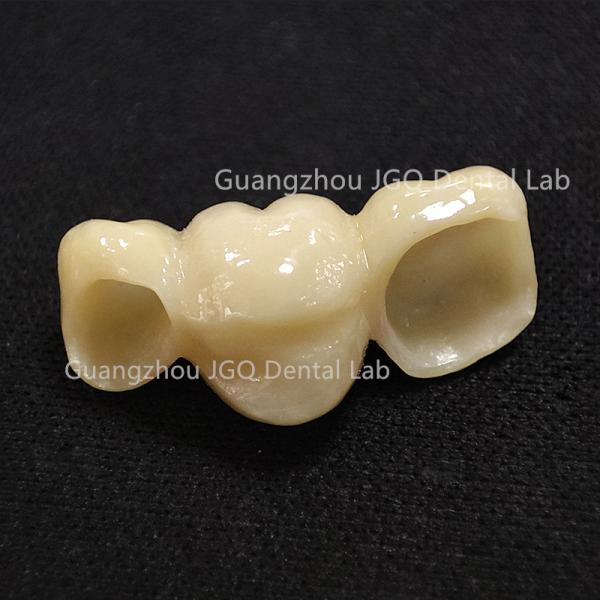 Quality High Quality Monolithic Zirconia Smooth Surface Precise Margin Fit for sale