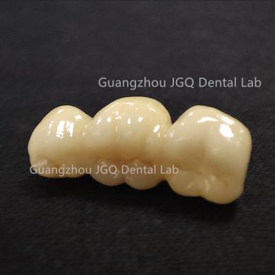 China Biocompatible Zirconia Crown CNC Milled Custom Aesthetic Durable Fast Service for sale