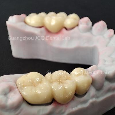 China Best Dental Products Suppliers OEM Milling 3D Printing Crown Zirconia with Gums for sale
