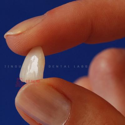 China Ivoclar Emax Laminate Veneers High Translucency China Dental Lab for sale