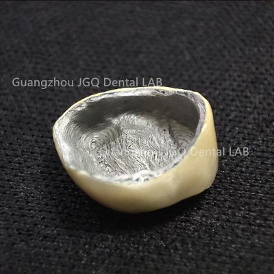 China Co Cr Dental Pfm Crowns and Bridges Fixed Denture Restorations China Dental Lab for sale