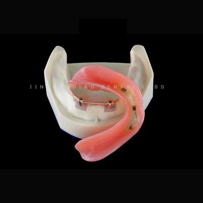 China Removable Denture Cobalt Chrome Precision Milled Attachments with Acrylic Teeth for sale