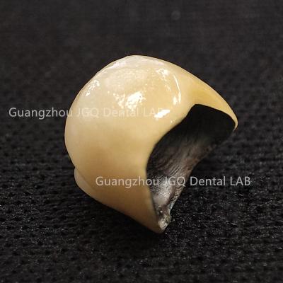 China PFM Porcelain Fused to Metal Dental Crown Natural Tooth Like for Oral Recovery for sale