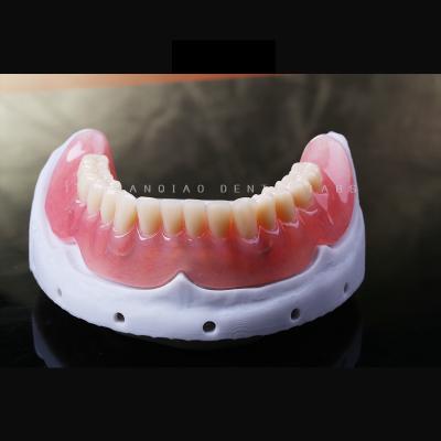 China Custom Removable Dentures Complete Acrylic Teeth Precision Titanium Bar China Dental Lab for sale