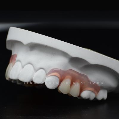 China Customized Flexible Valplast Denture from China Dental Lab for sale