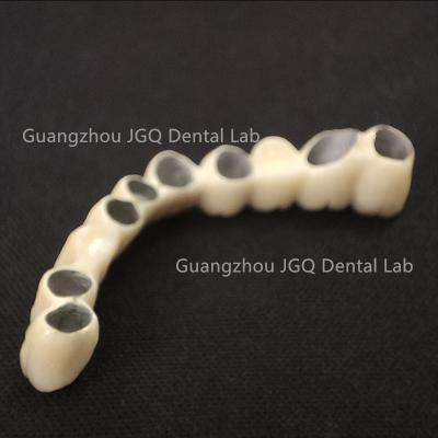China China Dental Lab Fabricated Dental Pfm Bridge Teeth Fast Fitting Customized for sale