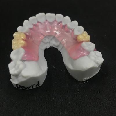 China Removable Flexible Denture Valplast Flexible Partial Dentures Prothesis China Dental Lab for sale