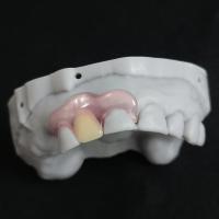 China Acrylic Removable Valplast Denture Durable for Restorative Dentistry for sale