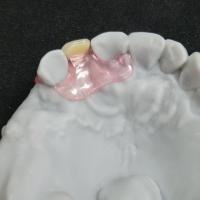 China Acrylic Removable Valplast Denture Durable for Restorative Dentistry for sale