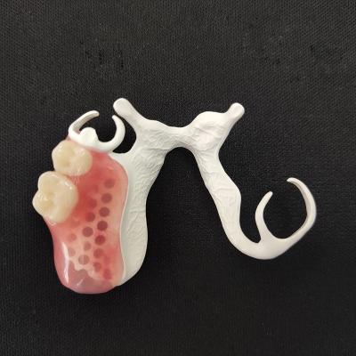 China Peek Material Removable Dentures Customized 3D Laser Printing for Natural Fit for sale