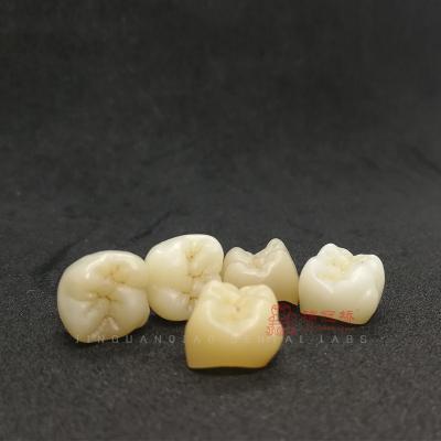 China Denture False Teeth PFZ Crowns Bridges Chinese Dental Lab Customized for sale