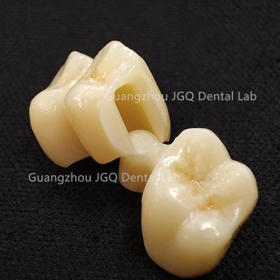 China Long Lasting Dental Zirconia Crown Bridge Customized Fast Turnaround for sale