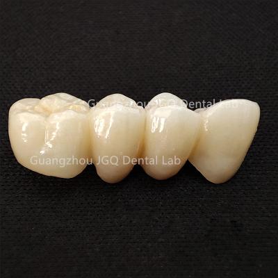 China Denture Restoration Zirconia Crown Dental Bridge Fast Turnaround 2-3 Days Customized for sale