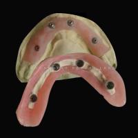 Quality Permanent Restoration Full Contour Zirconia Crown Dental Implant with Custom for sale