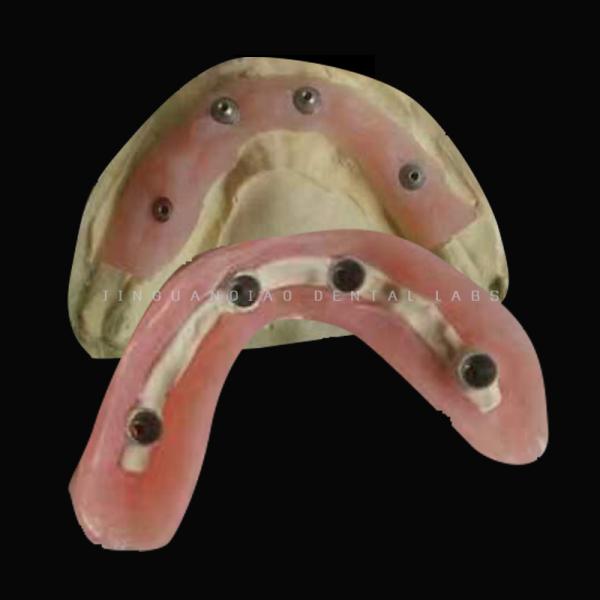 Quality Permanent Restoration Full Contour Zirconia Crown Dental Implant with Custom Milled Titanium Frame for sale