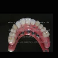 Quality Monolithic Zirconia Crown Full Jaw Implant Bridge Cement Retained Implant Crown for sale