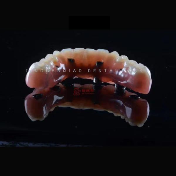 Quality Multi Unit Abutment Titanium Alloy Zirconia Bridge Dental Implant Durable Prosthesis for sale