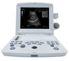 China Professional Sonography Machine 2-12 Mhz Frequency DC12.8V 3.0A Adapter Output for Accurate Diagnosis for sale